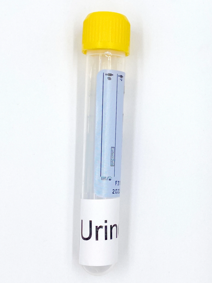 Cobas 4800 Urine Tube – ORDRS FFMT